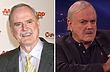 67 Celebrity Hair Transplants Before And After