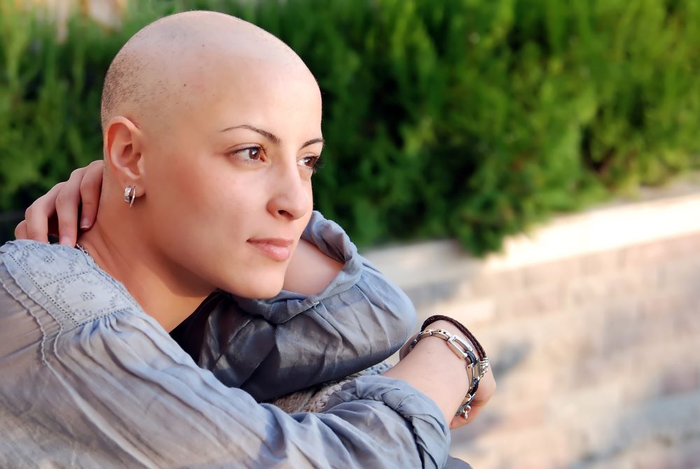 Does Radiotherapy Cause Hair Loss (And Can You Prevent It)?