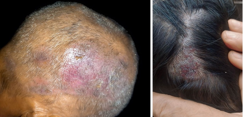 8 Common Scalp Problems: Photos, Causes, Treatments