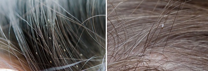 8 Common Scalp Problems: Photos, Causes, Treatments
