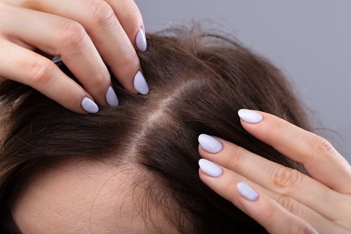 8 Common Scalp Problems: Photos, Causes, Treatments