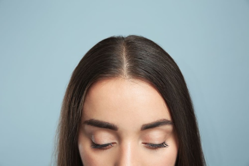 Getting A Temple Hair Transplant For Temple Hair Loss - Wimpole Clinic