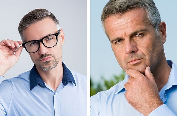 Mature Hairline Vs Receding Hairline: Which Do You Have?