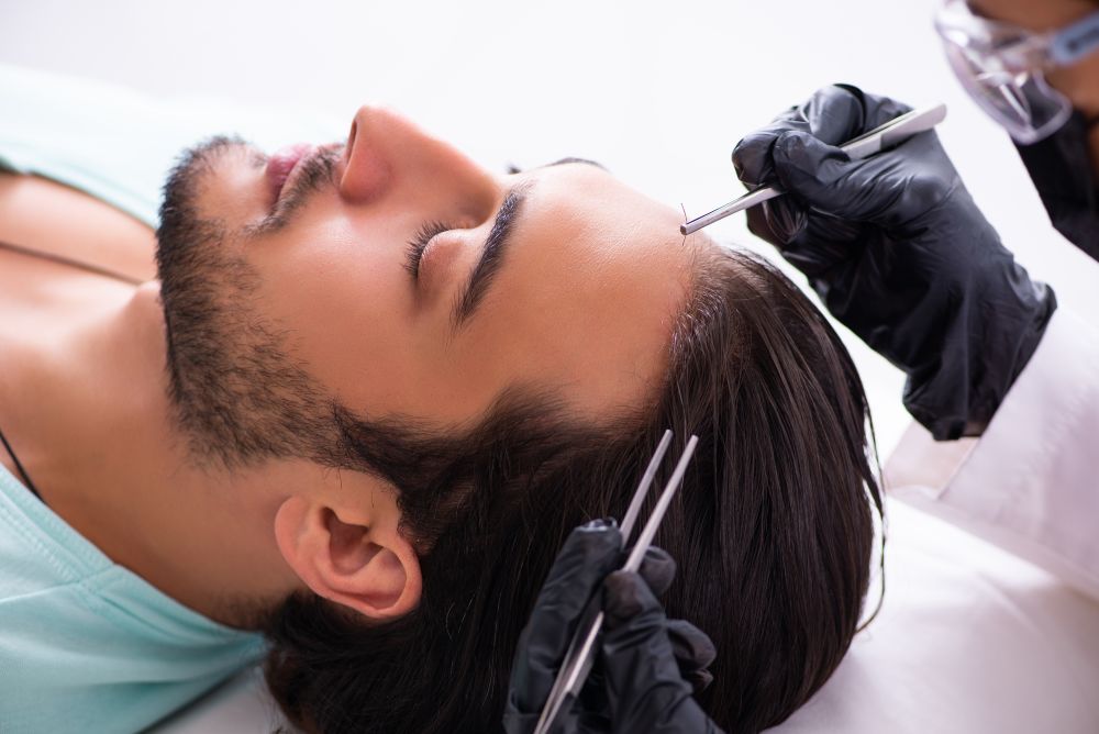 Hair Plugs vs Hair Transplant: What’s The Difference?