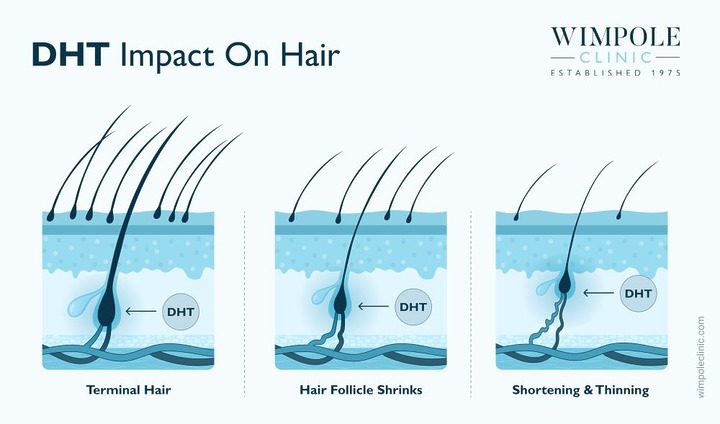 Normal Hair Parting Width vs Thinning: Causes and Treatments