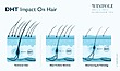 Thyroid Hair Loss: How To Spot Its Signs and Reverse It