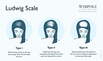 Ludwig Scale: Causes, Stages & Treatment | Wimpole Clinic