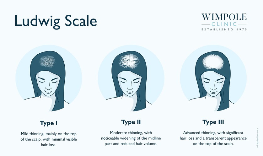 Ludwig Scale: Causes, Stages & Treatment | Wimpole Clinic