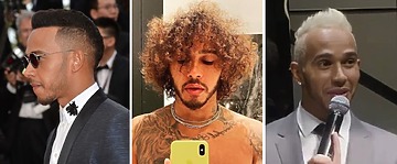 Lewis Hamilton Hair Transplant: Everything You Need to Know