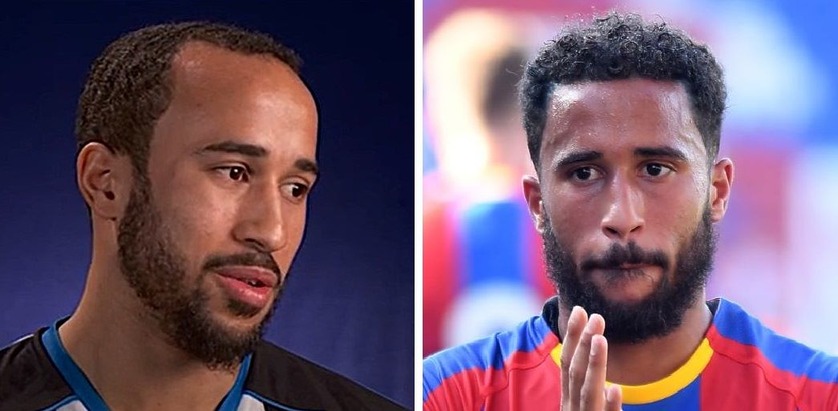 26 Footballer Hair Transplant Transformations | Wimpole Clinic