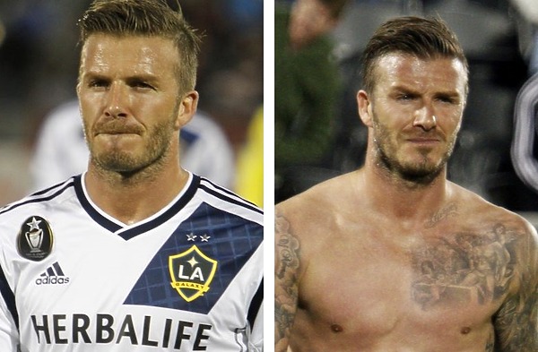David Beckham Hair Transplant: Everything You Need To Know