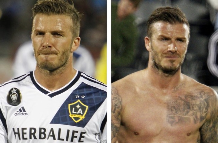David Beckham Hair Transplant: Everything You Need To Know
