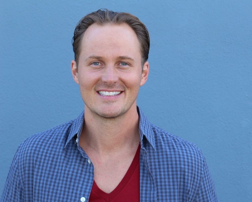 High Hairline: How to Identify, Treat, and Style Around It