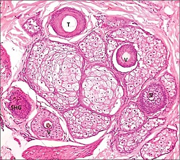 Blood Tests for Hair Loss: Diagnosing Female Hair Thinning