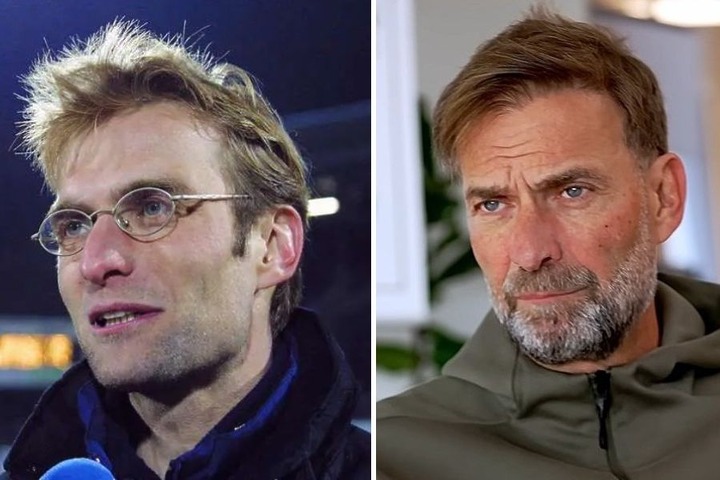 Jurgen Klopp Hair Transplant: Everything You Need To Know