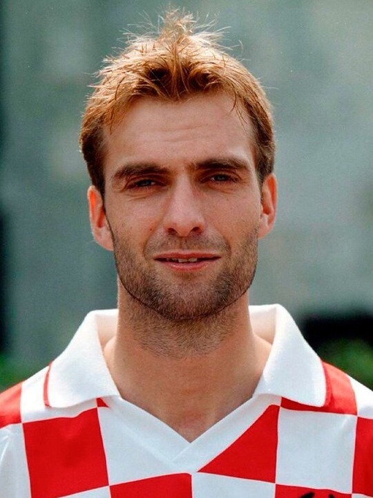 Jurgen Klopp Hair Transplant: Everything You Need To Know