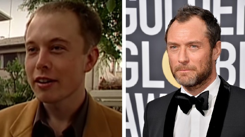 Norwood Stage 4: Photos, Treatments, Results | Wimpole Clinic