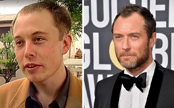 Norwood Stage 4: Photos, Treatments, Results | Wimpole Clinic