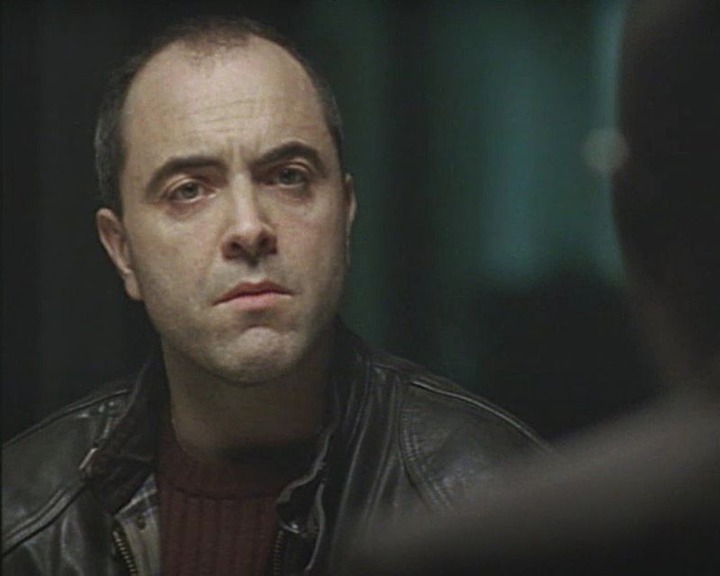 James Nesbitt Hair Transplant: Everything You Need to Know