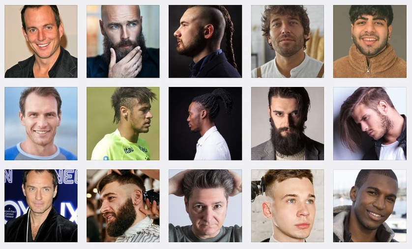 Temple Hair Loss: How To Prevent, Treat & Regrow Temples