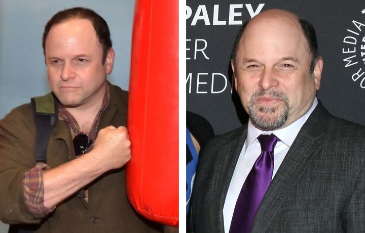 44 Famous Bald Celebrities In 2026 | Wimpole Clinic