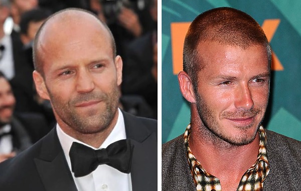 Balding on Top? 14 Best Haircuts for Balding Men & 5 to Skip