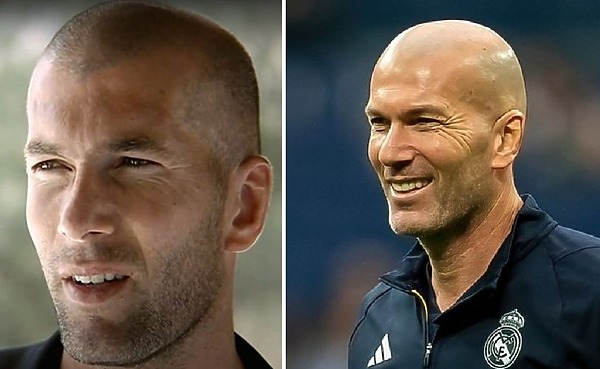 44 Famous Bald Celebrities In 2026 | Wimpole Clinic