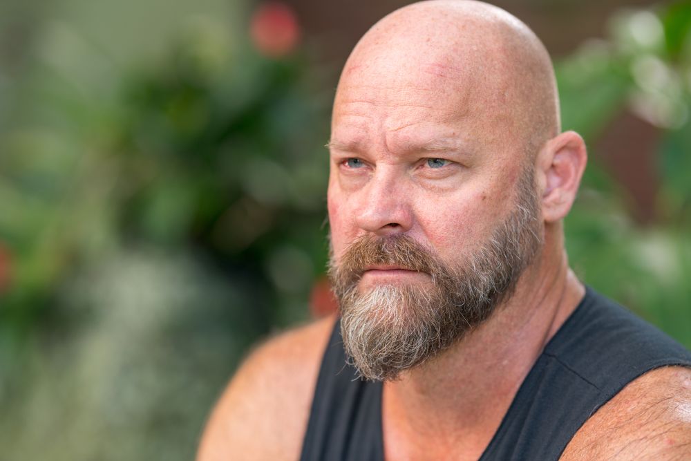 Norwood Stage 7: Photos, Treatments, Results