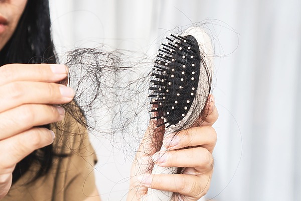 Does Low Testosterone Cause Hair Loss?