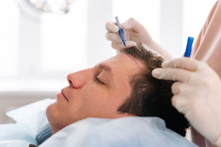 How to Fix Your Hairline: 9 Ways to Get It Back on Track