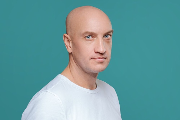 Alopecia Totalis: Causes. Symptoms, & Treatment - Wimpole Clinic