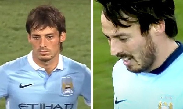 David Silva Hair Transplant: Everything You Need To Know