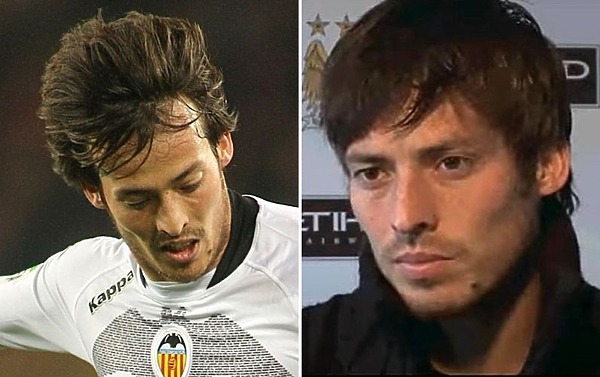 David Silva Hair Transplant: Everything You Need To Know