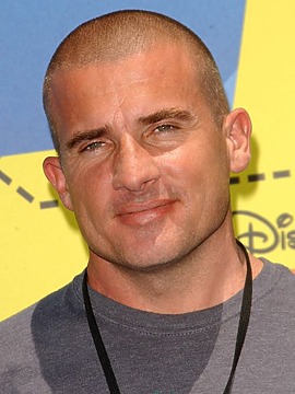 What is the Best Buzz Cut for a Receding Hairline? - Wimpole Clinic