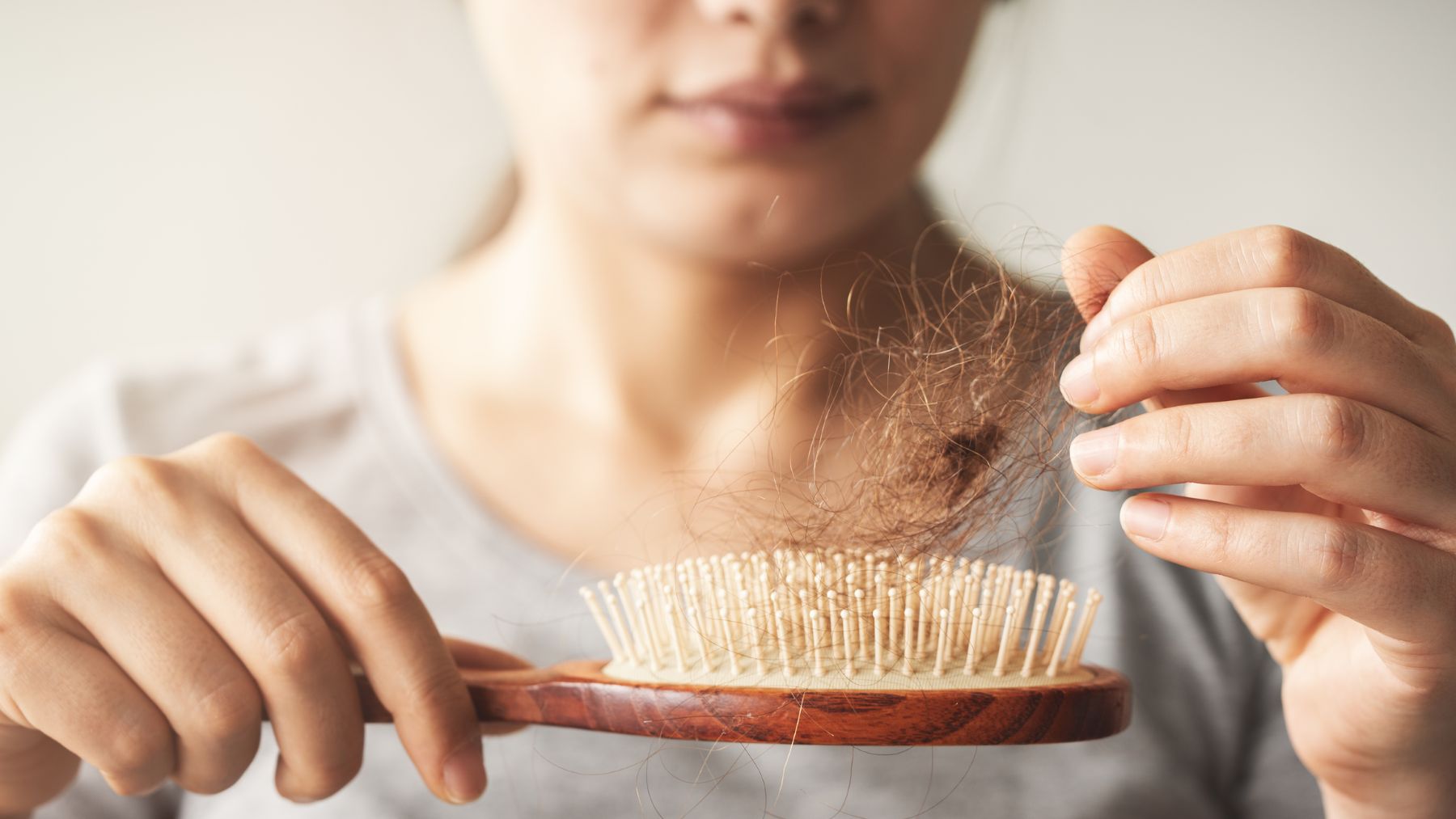 What is an M-shaped hairline? - Wimpole Clinic