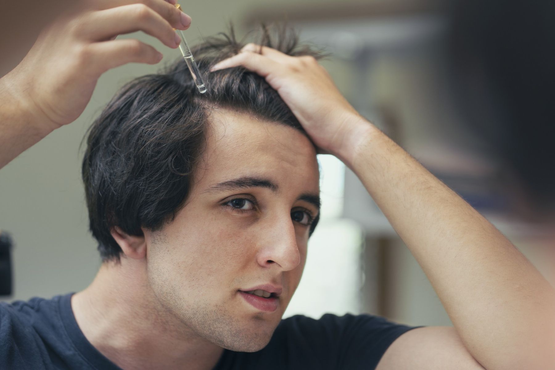 Minoxidil Timeline: How Long Does Minoxidil Take To Work?