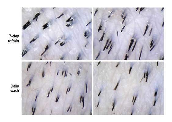 Does Not Washing Hair Cause Hair Loss? What Science Says