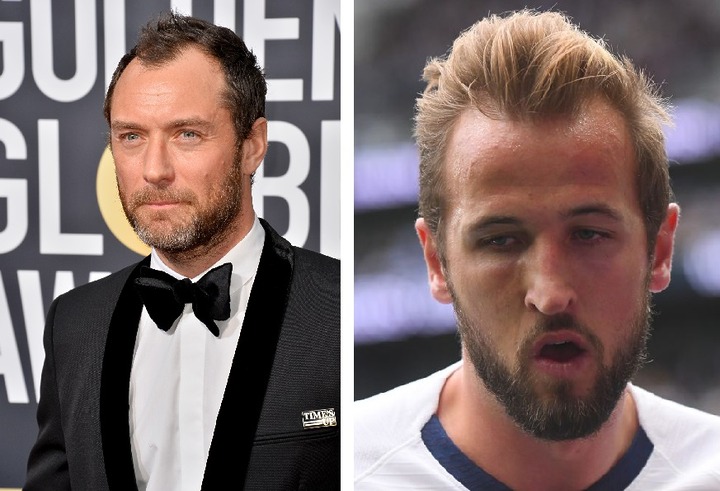 Widow's Peak Vs Receding Hairline: How to Tell Them Apart