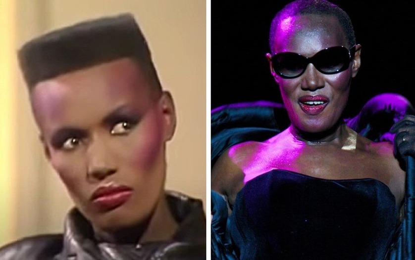 29 Bold Bald Women Who Rocked A Shaved Head - Wimpole Clinic