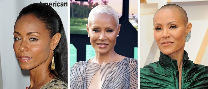 29 Bold Bald Women Who Rocked A Shaved Head - Wimpole Clinic