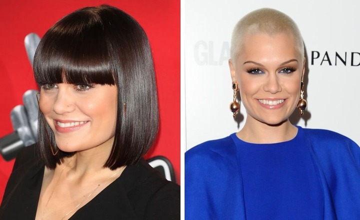 29 Bold Bald Women Who Rocked A Shaved Head - Wimpole Clinic