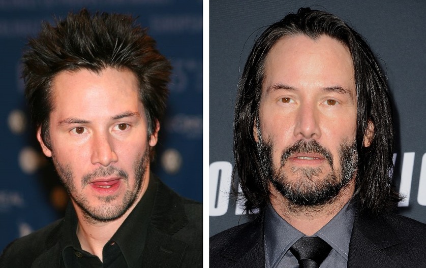 Widow’s Peak Vs Receding Hairline: How to Tell Them Apart