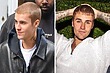 Justin Bieber Hair Loss: Everything You Need To Know