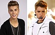 Justin Bieber Hair Loss: Everything You Need To Know