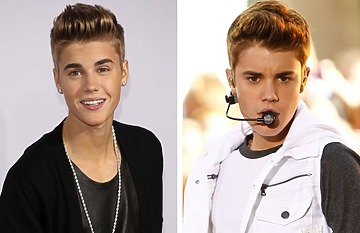 Justin Bieber Hair Loss: Everything You Need To Know