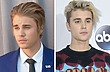 Justin Bieber Hair Loss: Everything You Need To Know