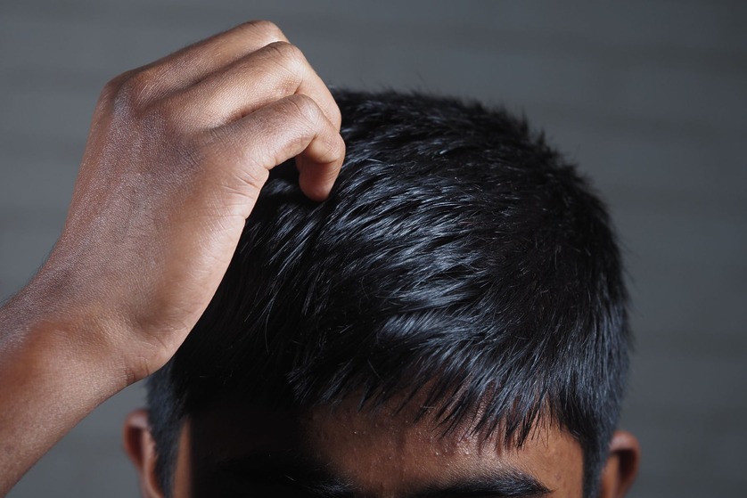 12 Reasons Your Scalp Itches a Day After Washing and What to Do