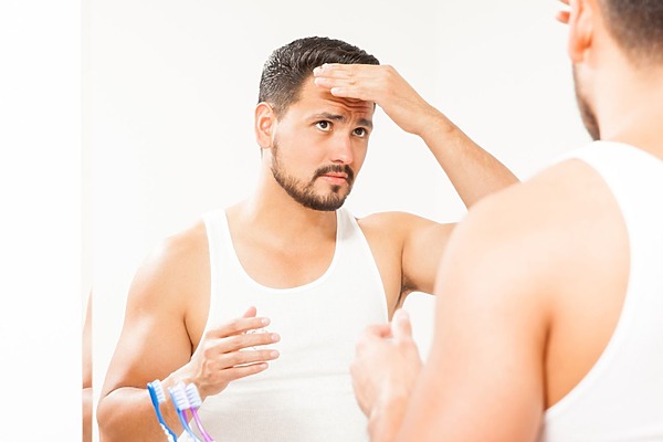 7 Ways To Tell Your Hairline Is Receding And The Best Treatments
