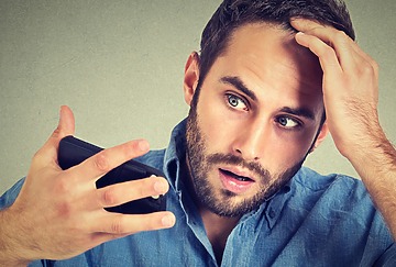 7 Ways to Tell Your Hairline is Receding (and Treatments)