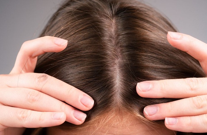 Normal Hair Parting Width vs Thinning: Causes and Treatments